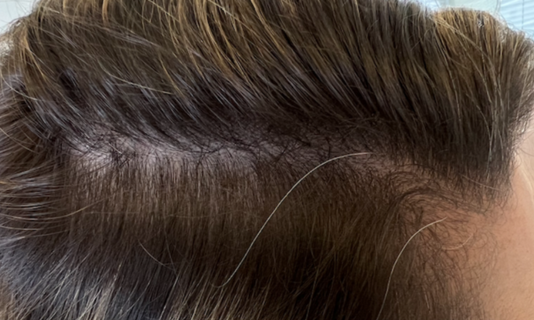 OSA - Óleo de Semente de Abóbora 30 Cápsulas | Anagrow – Anagrow ...